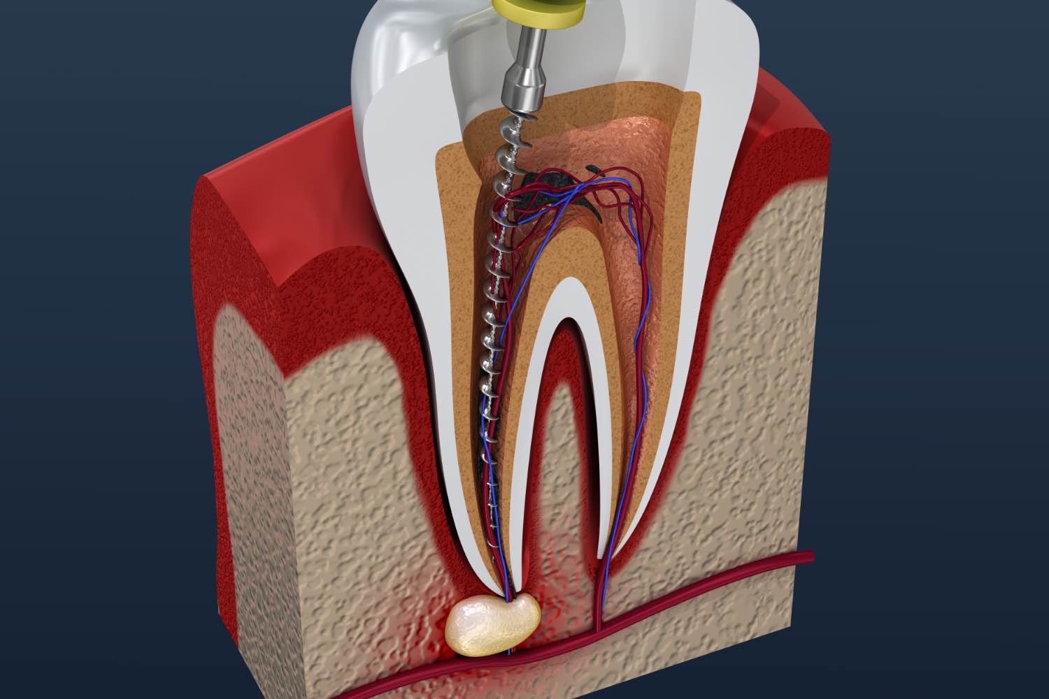 Root Canals Save Your Teeth and Aren’t as Scary as You Think!